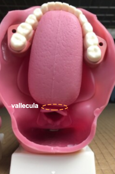 Vallecula: The Key Landmark Between the Tongue and Epiglottis